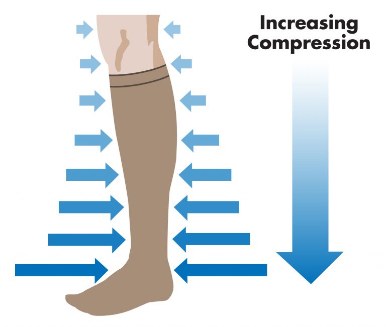 Compression Stockings – Northcliff Orthopaedic Centre
