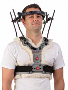 Cervical Neck Orthosis – Northcliff Orthopaedic Centre